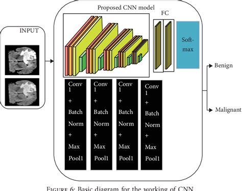 Figure 6 From Brain Tumor Detection And Classification By Mri Using Biologically Inspired