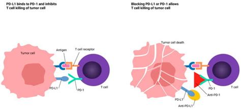 Comparative Efficacy And Safety Of Neoadjuvant Immunotherapy With Nivolumab Vs Pembrolizumab In