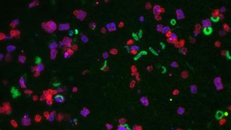 Immunology And Microbiology Science News Page 1010 Technology Networks