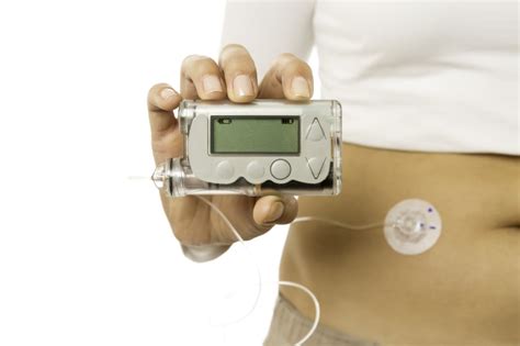 Insulin Pump Therapy Improves Quality Of Life In Adolescents With Type