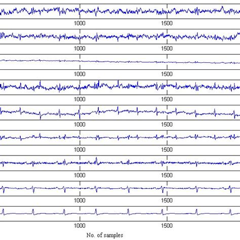 Mixture Of Fetal And Maternal Ecg Collected From Daisy Database I Have Download Scientific