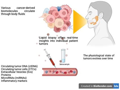 Salivary Gland Cancers In The Era Of Molecular Analysis The Role Of