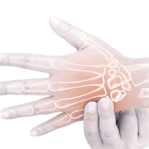 Top Orthopedic Doctors In Suffolk County Ny Broken Metacarpal