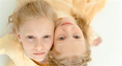 The Mystery Of Rare Twins Health Mad