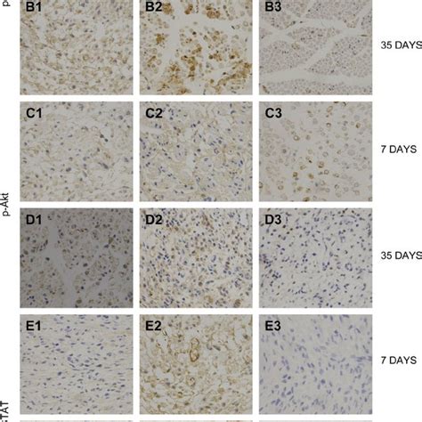 Cross Semithin Sections Of Regenerated And Normal Sciatic Nerves In