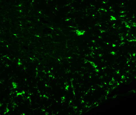 How To Use The Microglia Analyzer” Widget — Microglia Analyzer 001 Documentation