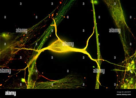 Hippocampal Neuron Fluorescent Micrograph Of A Neuron Nerve Cell
