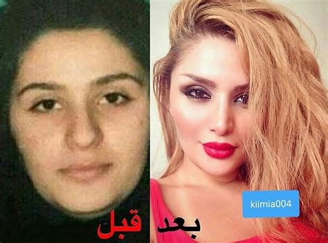 دنیا جهان بخت：عکسی که از ۱۸ سالگیم منتشر شده بیانگر اینه که چهره ام