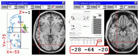 Mricro Software Guide