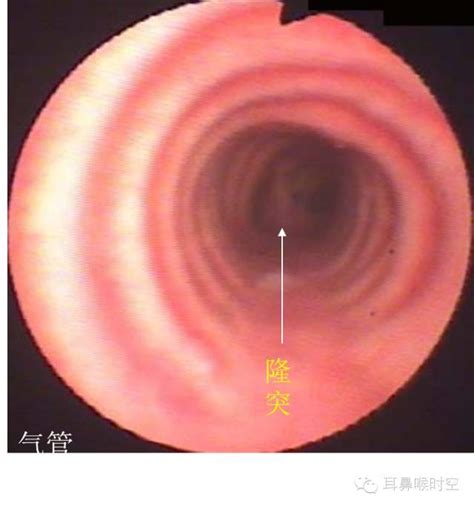 图文解说气管、支气管与食管的应用解剖及生理学 医学界 助力医生临床决策和职业成长