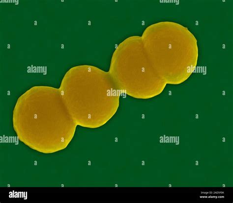 Coloured Scanning Electron Micrograph Sem Of Streptococcus Pyogenes