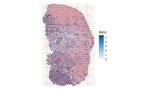 Spatial Visium Exploratory Data Analysis • Voyager