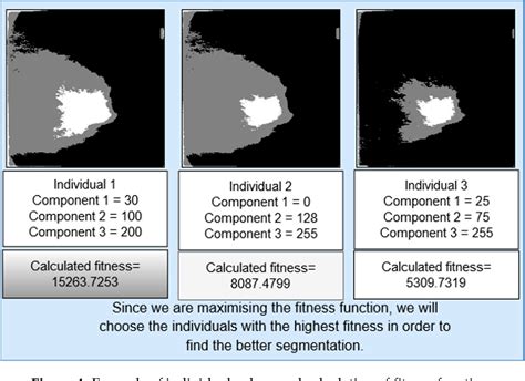 Figure 4 From A Novel Bio Inspired Method For Early Diagnosis Of Breast Cancer Through