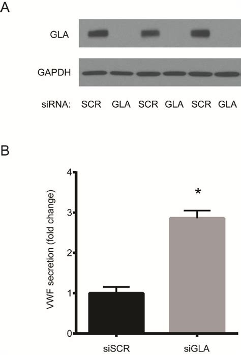Elevated Vwf Secretion In Eahy926 Cells Following Gla Knockdown