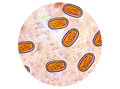 Enterobius Vermicularis Ev Eggs Parasite In Stool Image Under Light