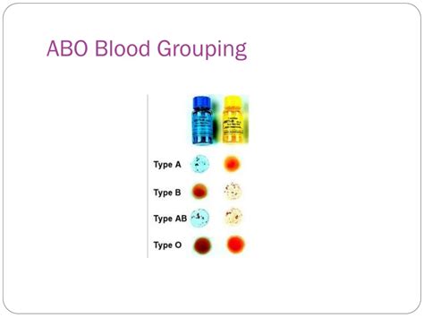 Ppt 2 Basic Immunologic Procedures Part 5 Agglutination Powerpoint Presentation Id 9639214