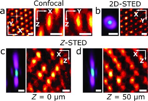 Alignment Of Confocal Sted Microscope A Slices From A Confocal Z Stack
