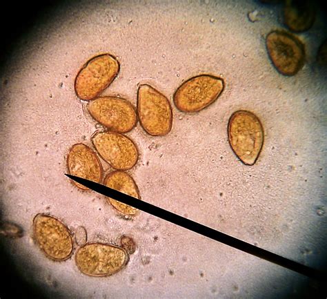 Southern Vs Common Rust In Corn Jenreesourcess Extension Blog