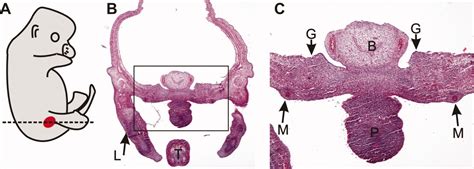 Gubernaculum Testis Tail