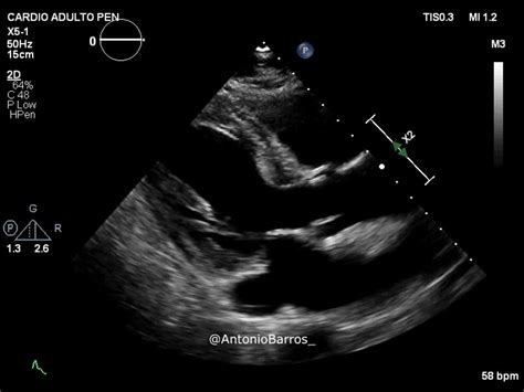 Alexandre D On Linkedin Plsvc