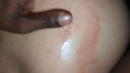 Bloody Pame Back Shots Eporner