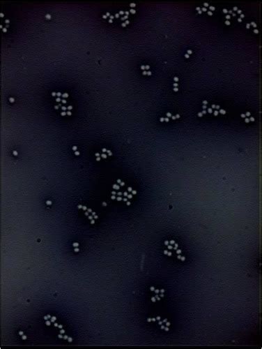 Negative Stain Nigrosin