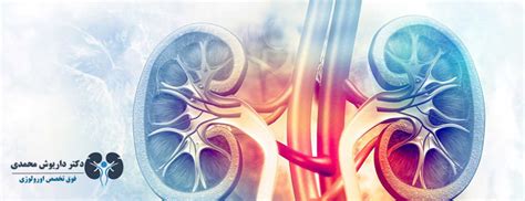 کیست آدرنال غده فوق کلیه عکس غده فوق کلیه عوارض برداشتن غده فوق کلیوی