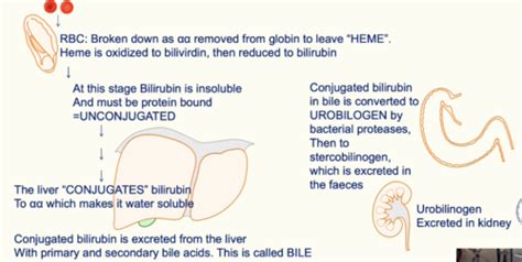 Biliary Disease And Gallstones Flashcards Quizlet