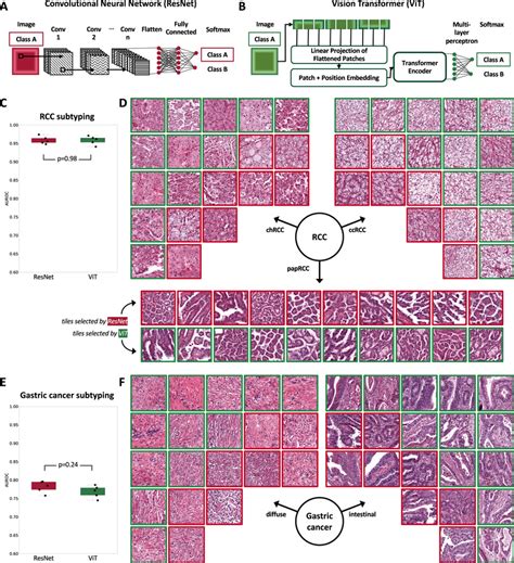 Cancer Subtyping With Deep Learning A Image Classification With Resnet