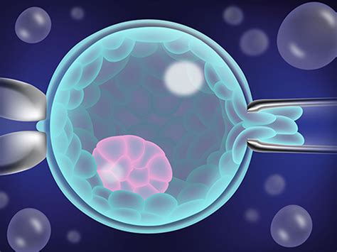 Pgt White Rose Fertility Centre
