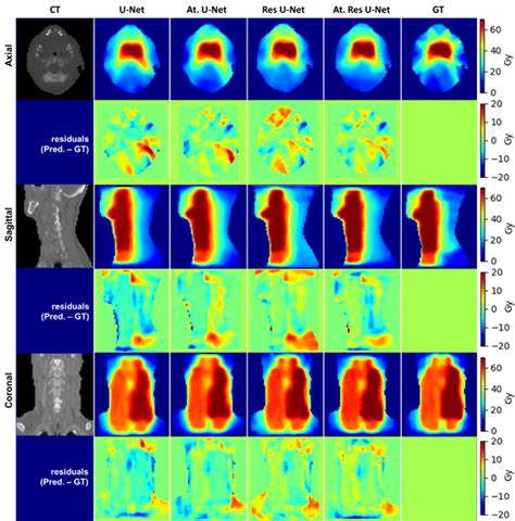 Github Afiosman Deep Learning Kbp Methods For Rt Dose Prediction