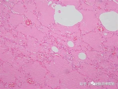 切片学习 常规病理组织切片及诊断要点 知乎
