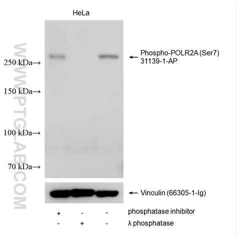 Phospho Polr2a Ser7 Antibody 31139 1 Ap Proteintech