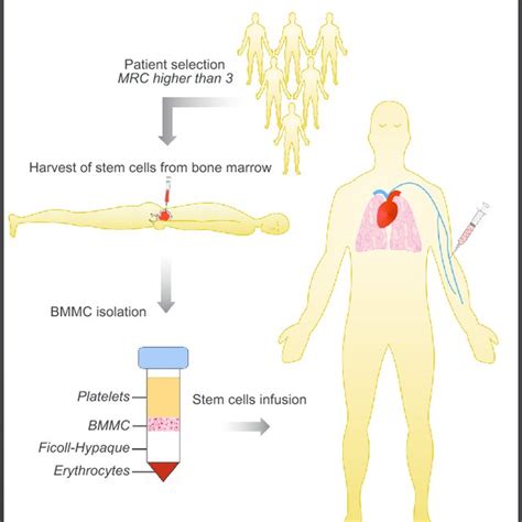 A Forced Vital Capacity Fvc B Percentage Of Predicted Fvc Pre And Download Scientific