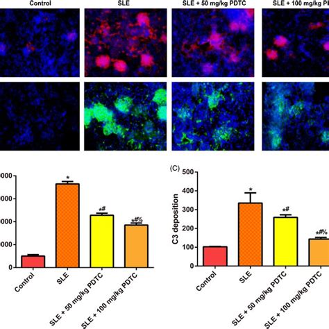 Effect Of Nf‐κb Inhibitor Pdtc On Biochemical And Immunological