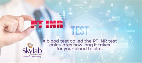 Knowing The Pt Inr Test What Is The Prothrombin Time And Inr Normal Range Clinical