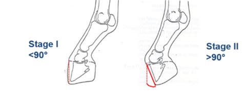 Flexural Limb Deformities Flashcards Quizlet