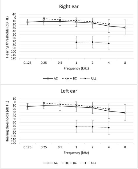 Figure 1 From Hyperacusis Assessment Questionnaire—a New Tool Assessing