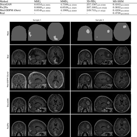 figure 2 from conditional diffusion models for semantic 3d medical