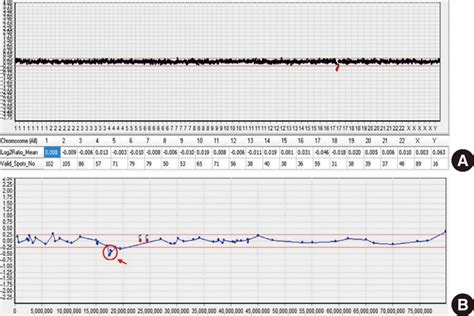 array cgh result of patient 1 a array cgh data profile in whole