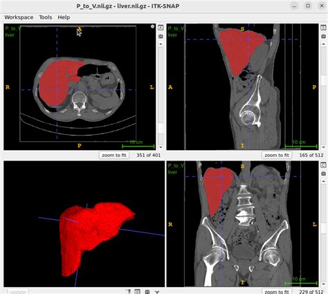 Python版：使用totalsegmentator工具可在1分钟内自动分割全身117个器官，附批量技巧 Csdn博客