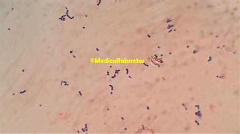 Streptococcus Pyogenes Introduction Morphology Pathogenicity Streptococcus Pyogenes Introduction Morphology Pathogenicity