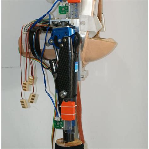 Intelligent Lower Limb Prosthesis Prototype Download Scientific Diagram