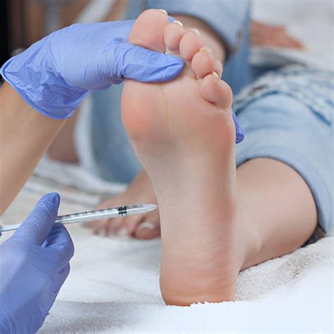 Hyperhidrosis Treatment Dubai Elite Body Home Polyclinic