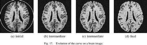 Figure 1 From A Nonparametric Statistical Method For Image Segmentation