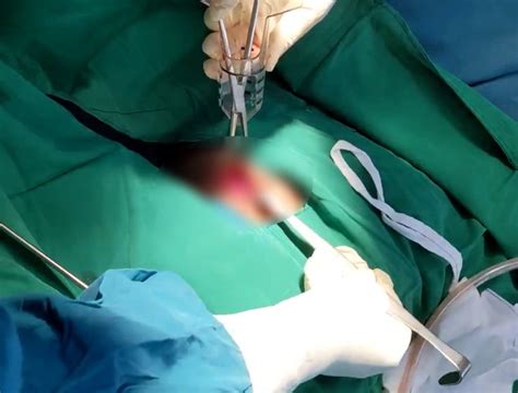 Nh P Vi N C P C U V D Ng V T Gi N M Trong H U M N