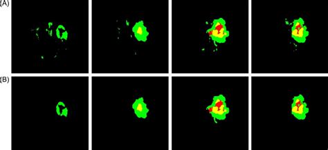 Post‐processing Results A Segmented Image Before Post‐processing And Download Scientific