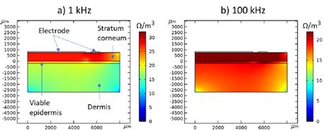 Axisymmetric 2d Distribution Of Simulated Volume Impedance Density