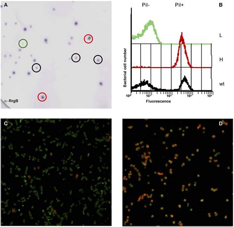 Figure 3 From The Streptococcus Pneumoniae Pilus 1 Displays A Biphasic Expression Pattern