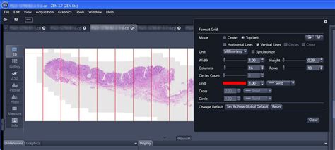 Creating Distance Measurement Gridlines In Qupath Usage And Issues Imagesc Forum